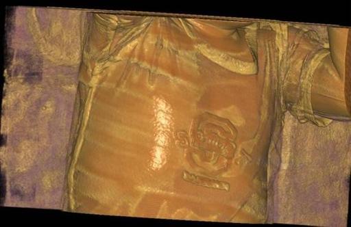 Pediatric - Computed Tomography - Siemens Healthineers USA