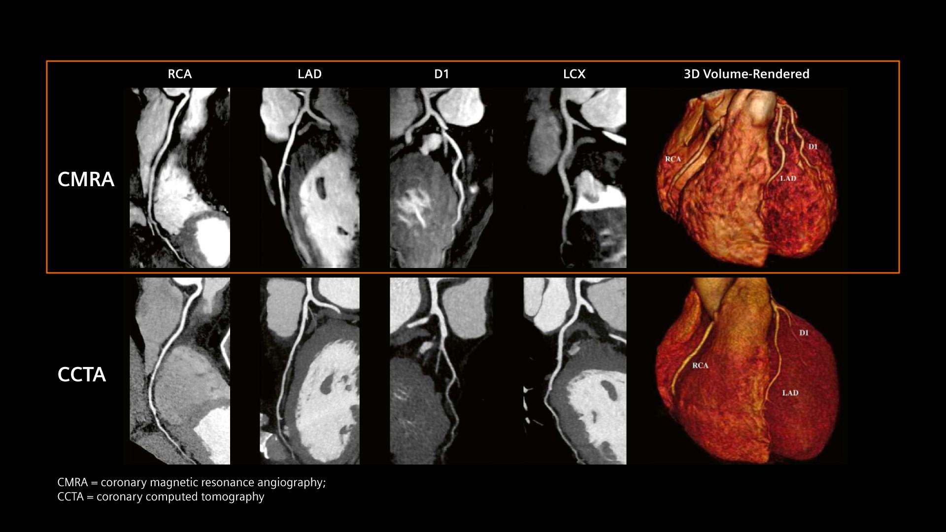 Cardiovascular MRI - Siemens Healthineers