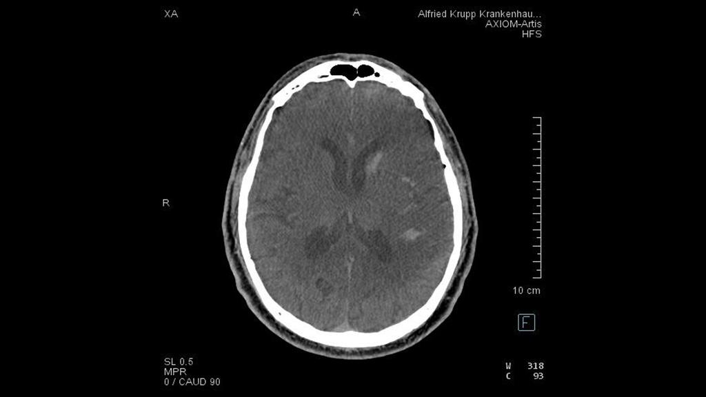 syngo DynaCT - Siemens Healthineers USA