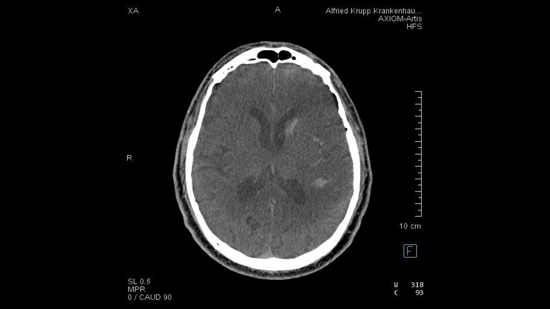 syngo DynaCT - Siemens Healthineers USA