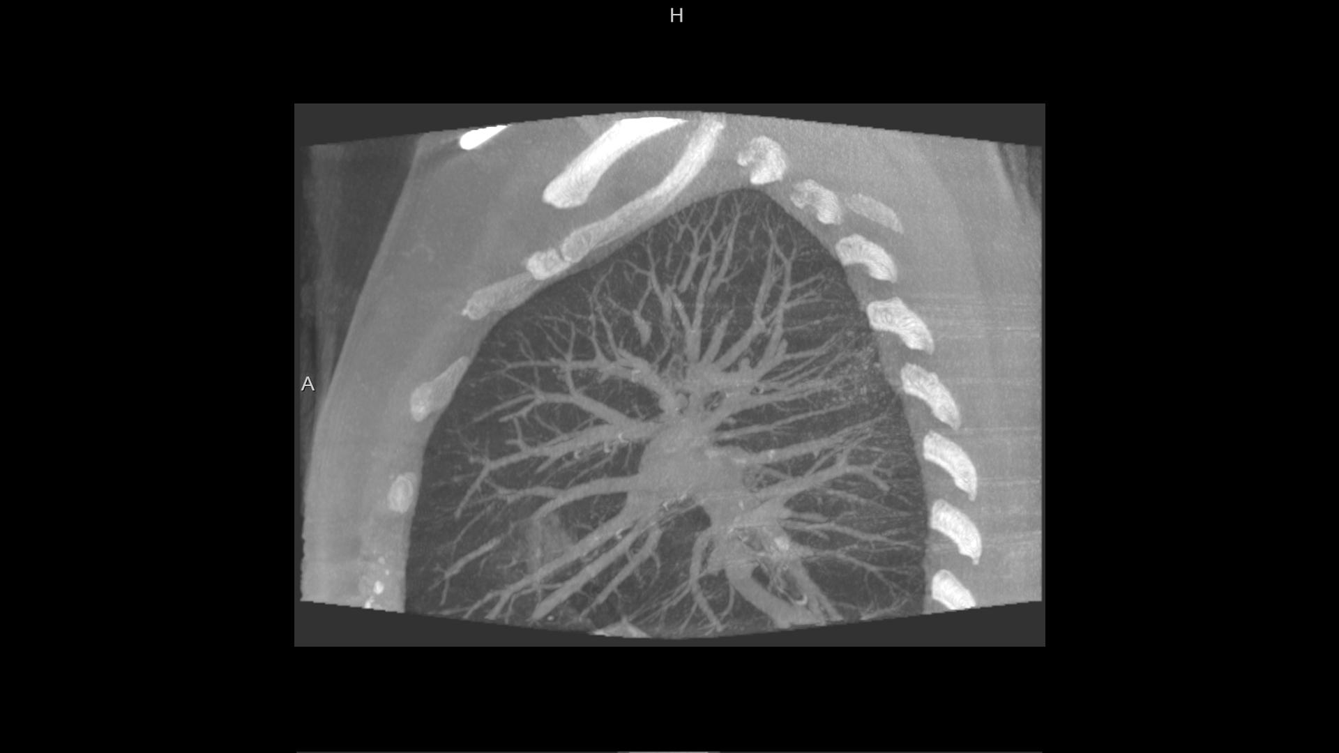 syngo DynaCT - Siemens Healthineers USA