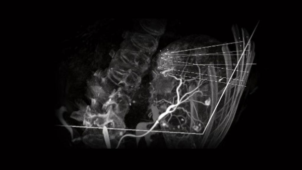 ARTIS pheno - Siemens Healthineers