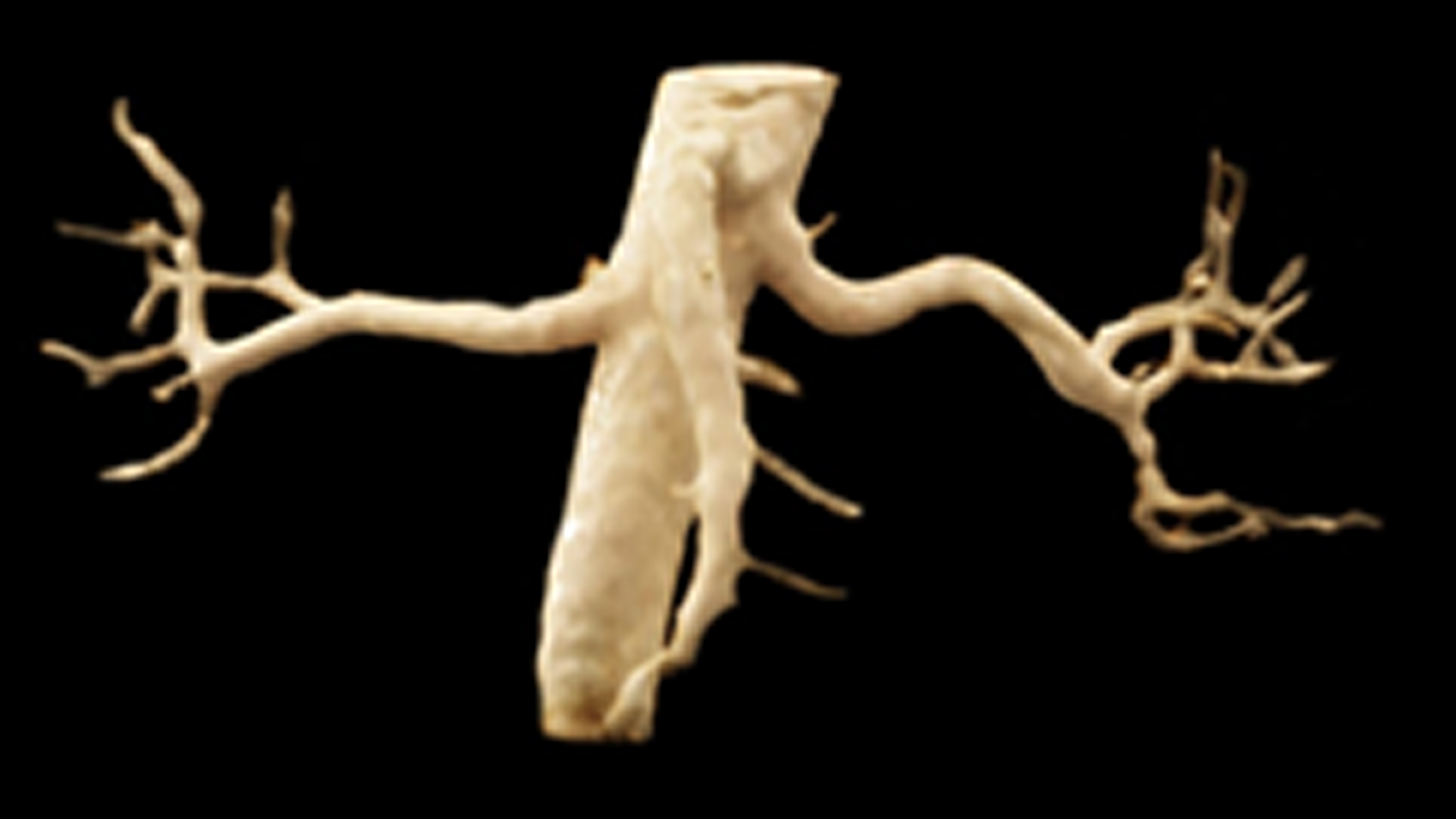 BioMatrix Technology - Siemens Healthineers