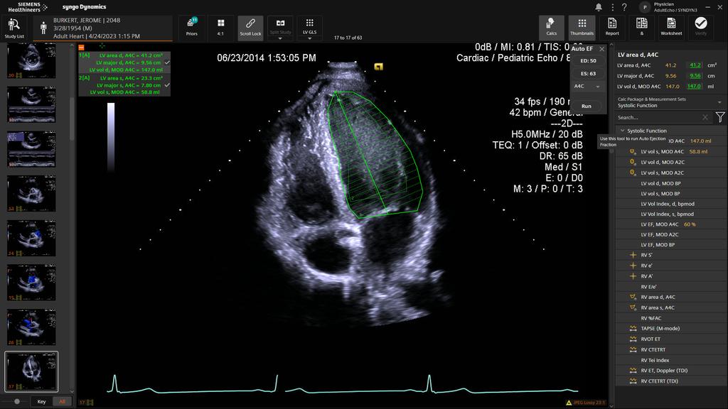 What Would Happen if You Could Better Manage Cardiovascular Imaging ...