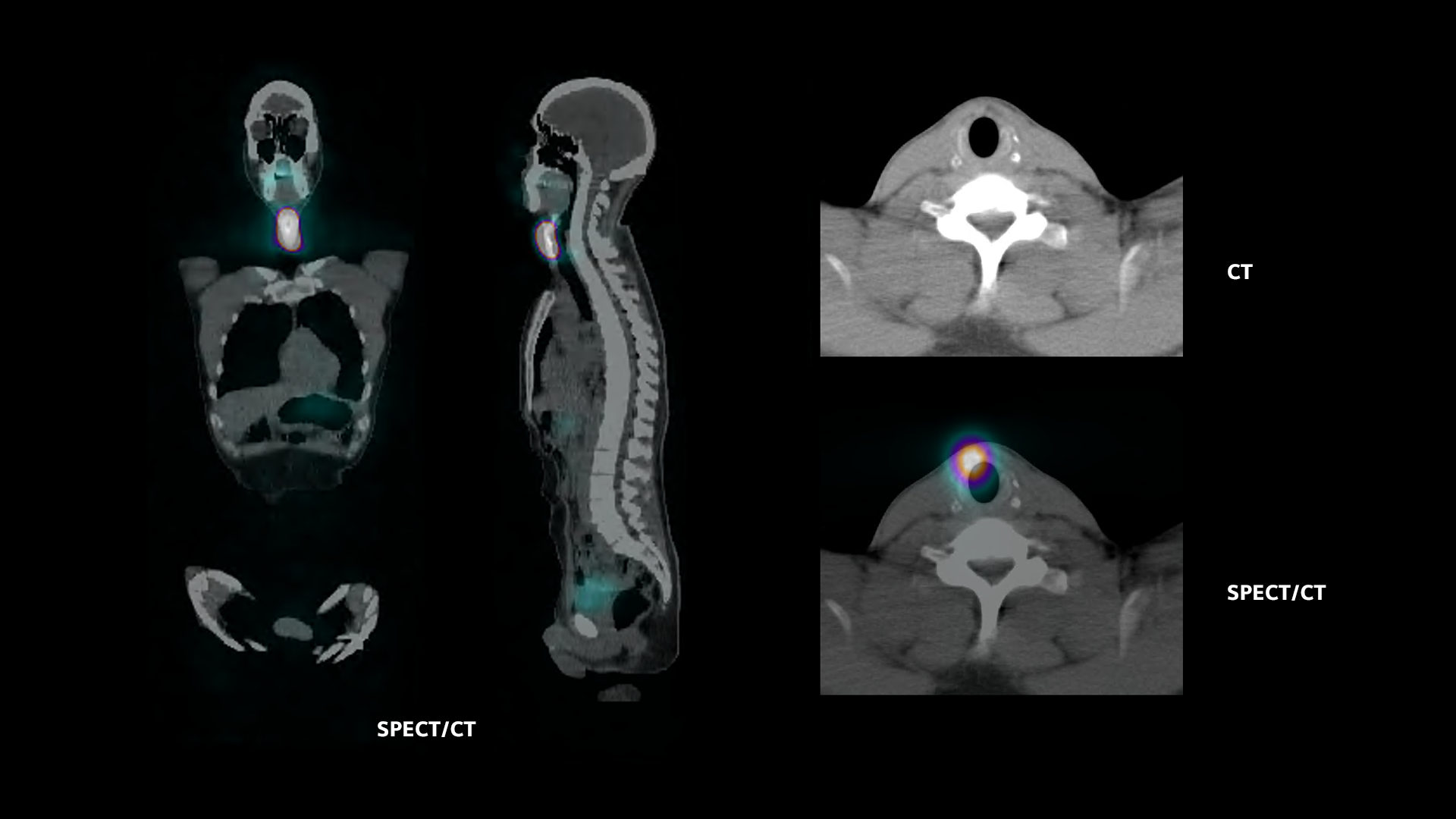 Symbia Pro.specta SPECT/CT - Siemens Healthineers