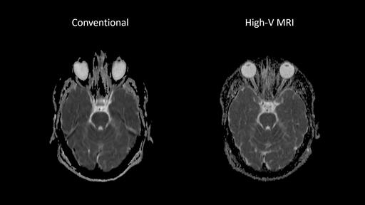 MAGNETOM Free.Max – Open Bore MRI - Siemens Healthineers USA