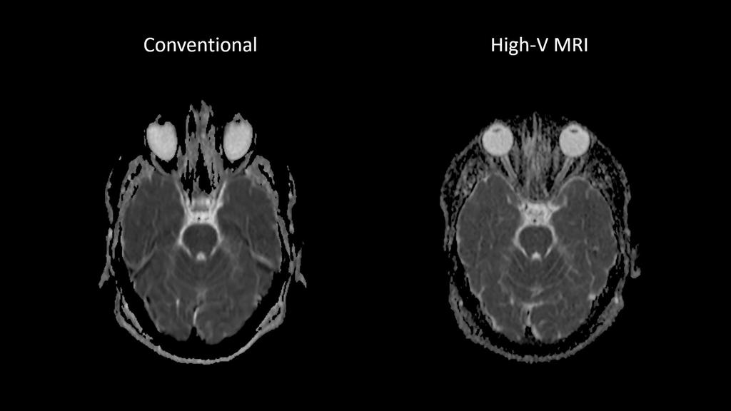 MAGNETOM Free.Max – Open Bore MRI - Siemens Healthineers USA