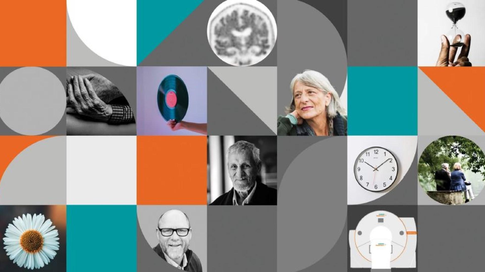 PET/CT biomarkers enable clinicians to advance Alzheimer’s disease care ... PET/CT biomarkers enable clinicians to advance Alzheimer’s disease care ...