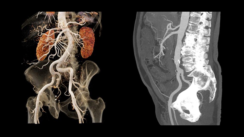SOMATOM Drive eco – CT Scanner - Siemens Healthineers