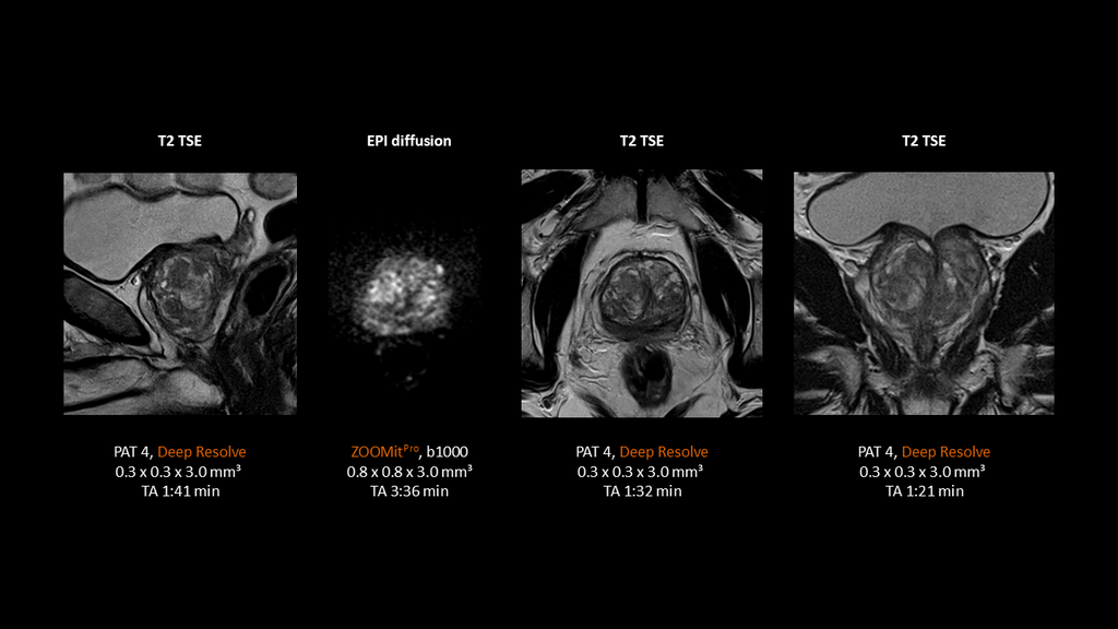 MAGNETOM Altea 新時代に求められる生産性と再現性 - Siemens Healthineers Japan