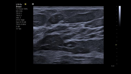ACUSON Maple is a High-Performance Shared Service Ultrasound System ...