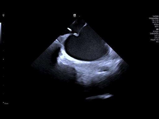 AcuNav Lumos 4D ICE Catheter - Siemens Healthineers