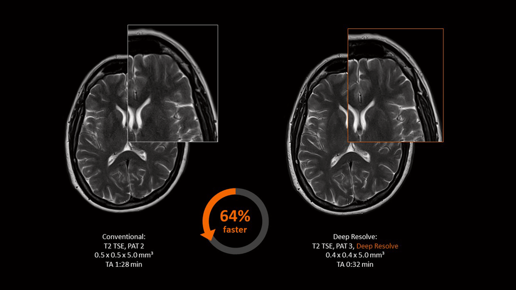 MAGNETOM Viato.Mobile - Siemens Healthineers