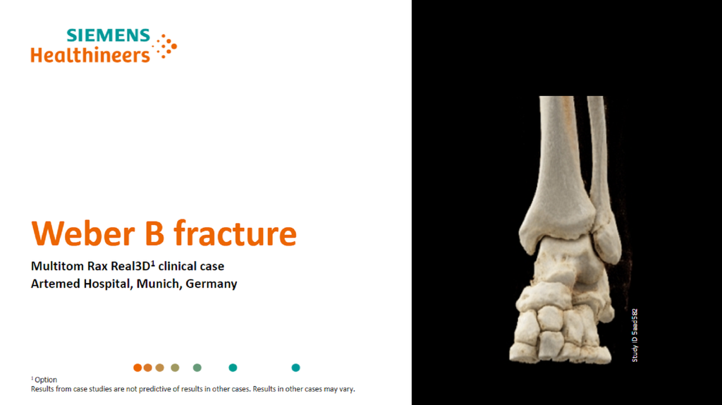 Robotic X-Ray - Clinical Case Library - Siemens Healthineers