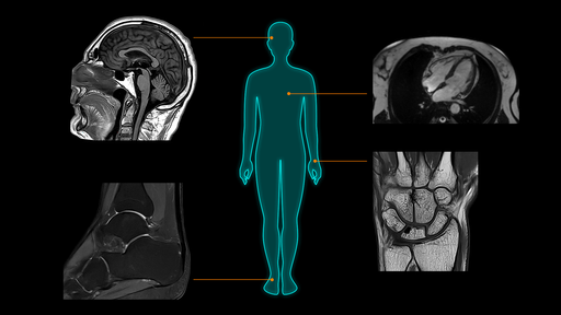 MAGNETOM Flow.Ace - Siemens Healthineers USA