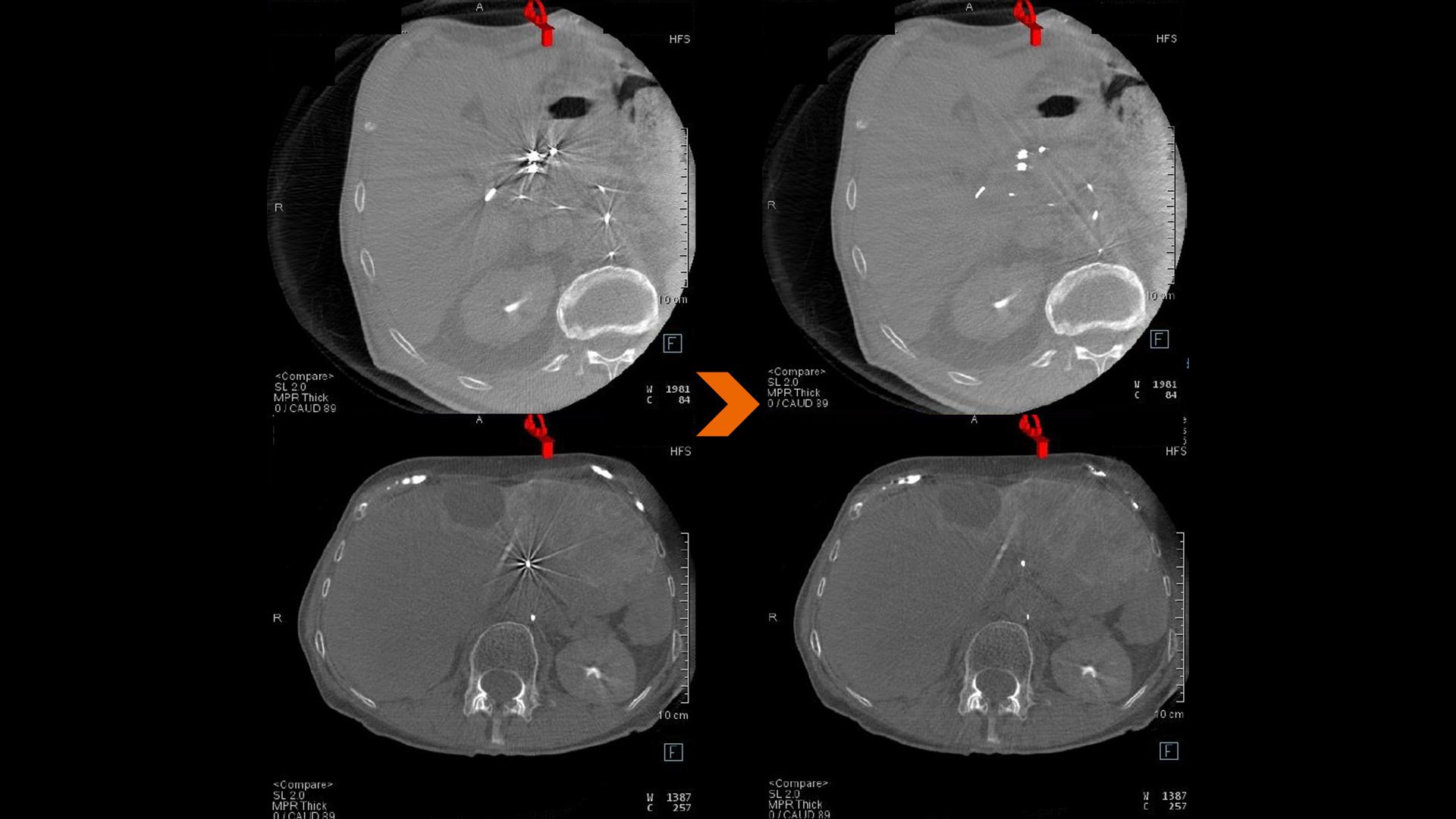 syngo DynaCT - Siemens Healthineers