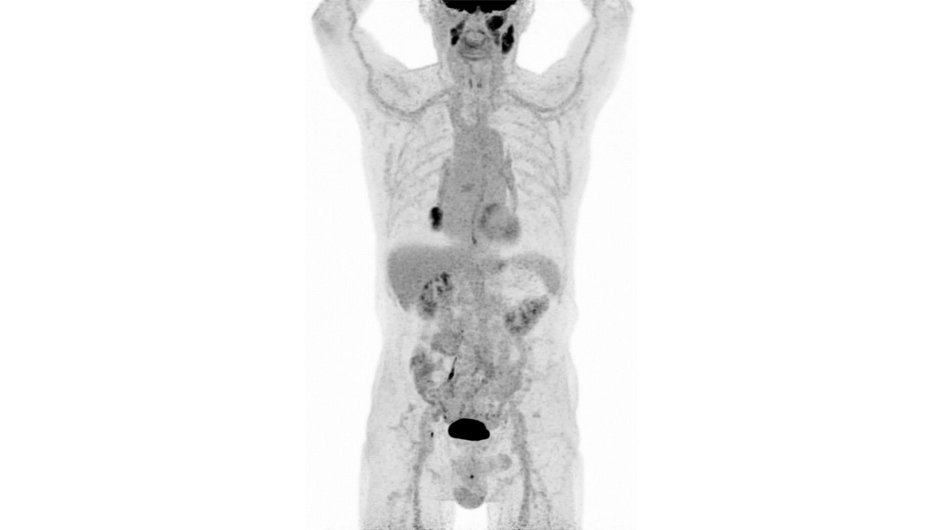 Biograph PET/CT family - Siemens Healthineers USA