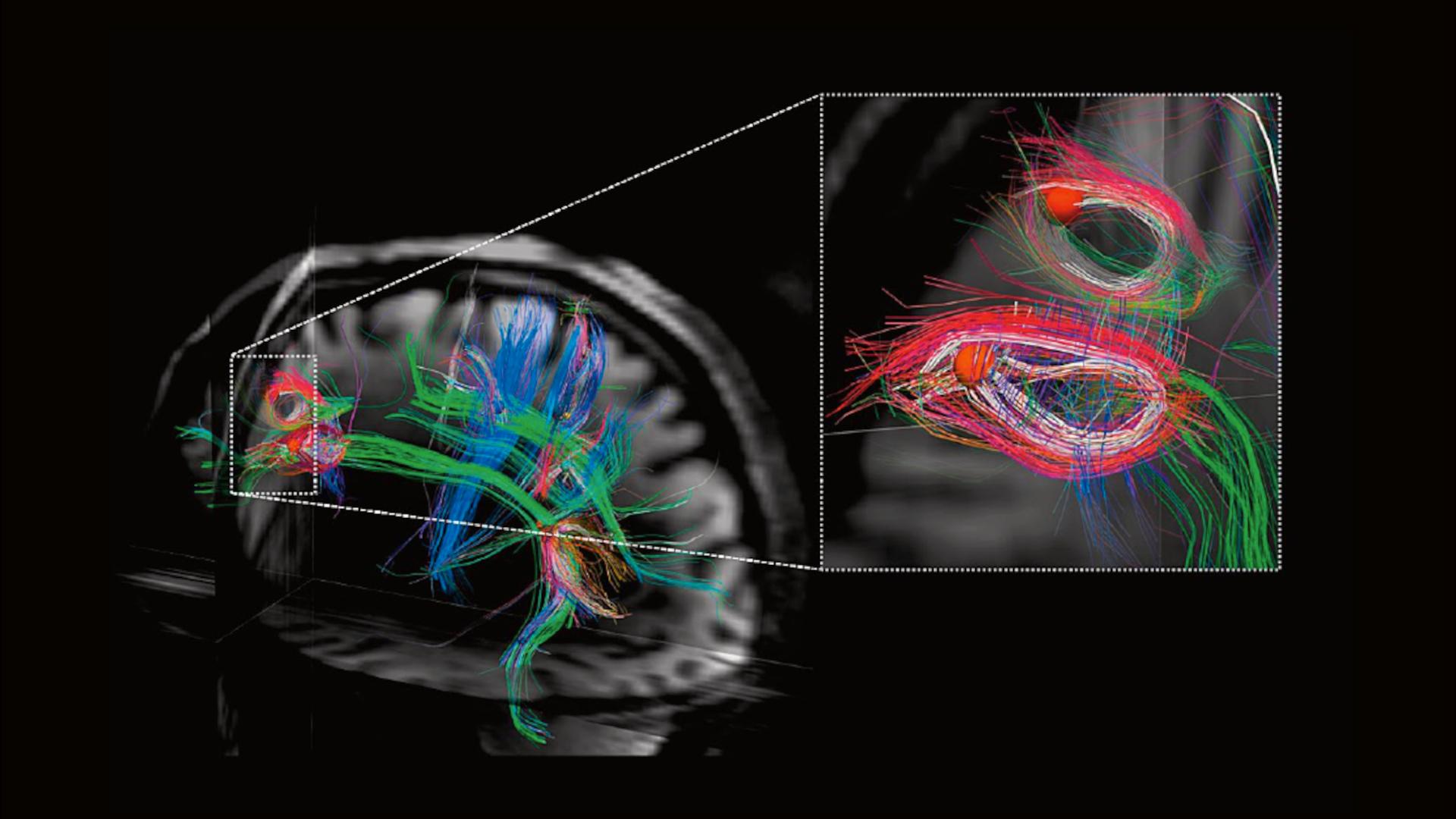 MAGNETOM Cima.X - Make the difference. - Siemens Healthineers