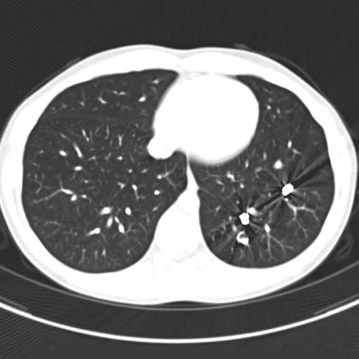 iMAR - Siemens Healthineers