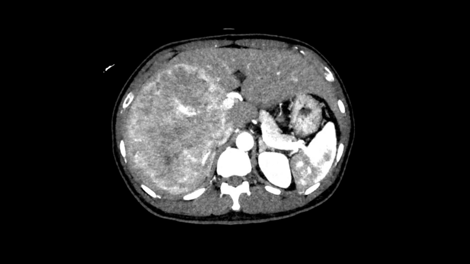 The difference between images and answers with Dual Energy CT