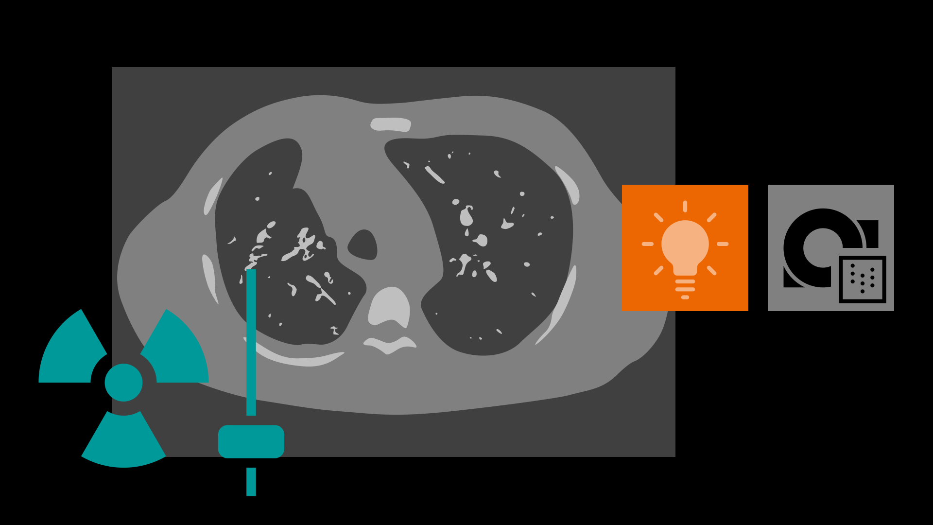 The best of both worlds: Ultra-high-pitch pulmonary angiography with ...