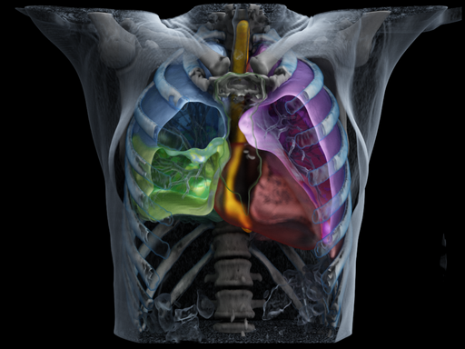 Autocontouring in radiation therapy - Siemens Healthineers - Siemens ...