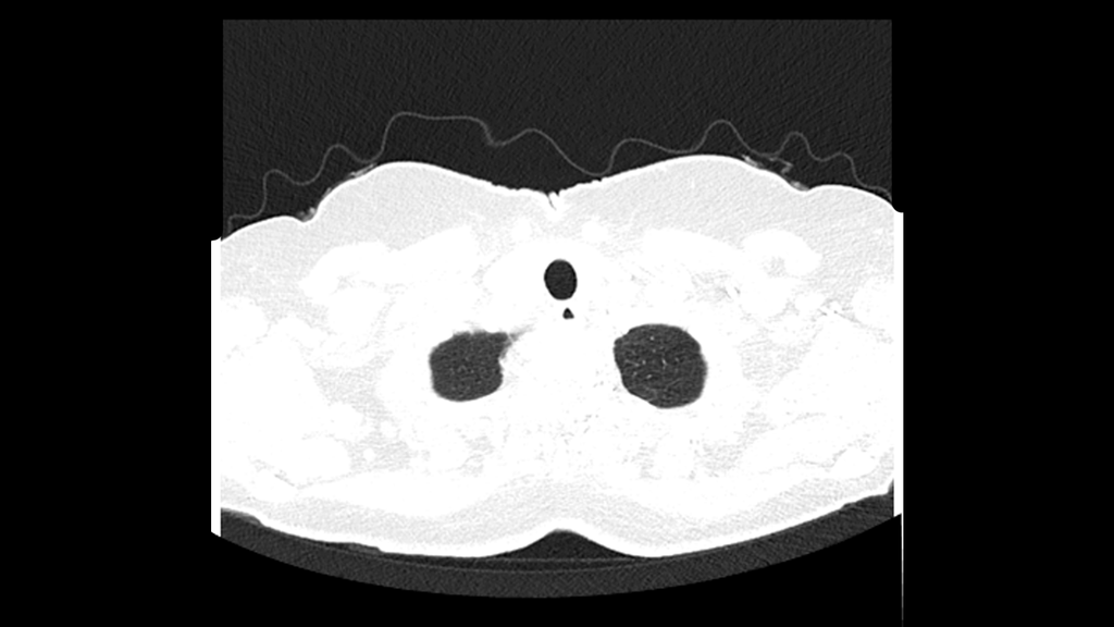 The Siemens Healthineers CT Imaging Chain - Siemens Healthineers
