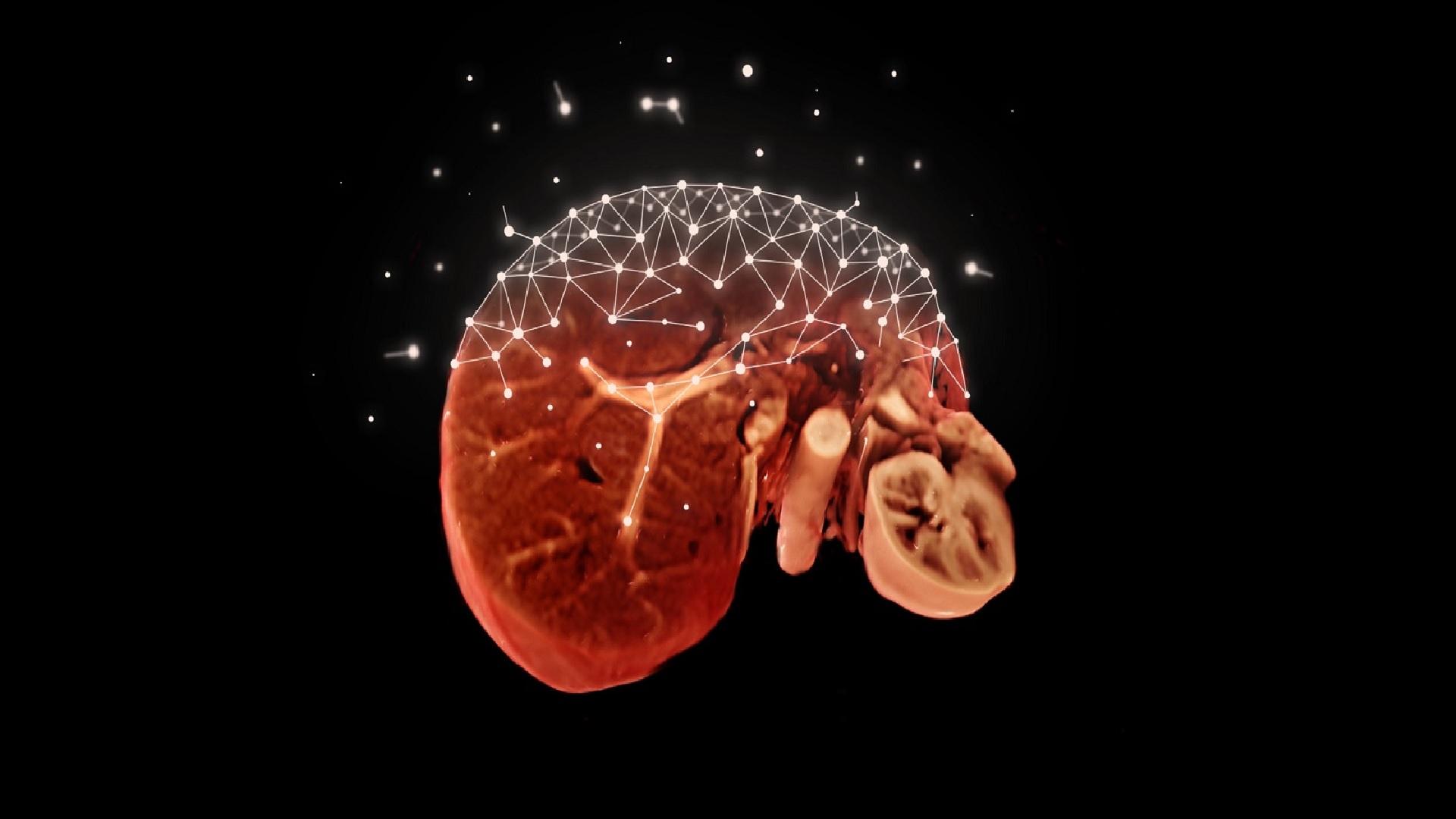 MAGNETOM Avanto Fit - Siemens Healthineers