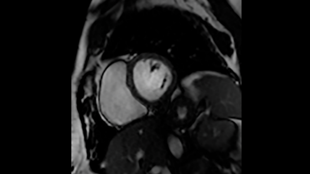 BioMatrix Technology - Siemens Healthineers