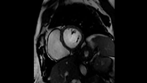 BioMatrix Technology - Siemens Healthineers