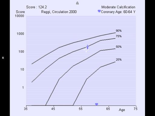 CT calcium scoring: Ultra low dose coronary Ca scoring screening ...
