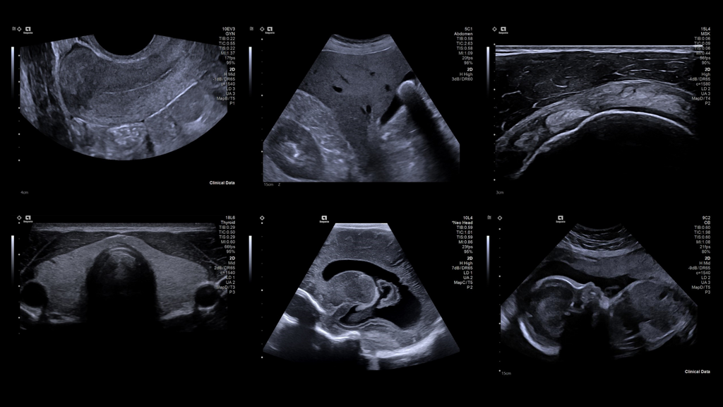 ACUSON Sequoia Ultrasound System - Siemens Healthineers USA