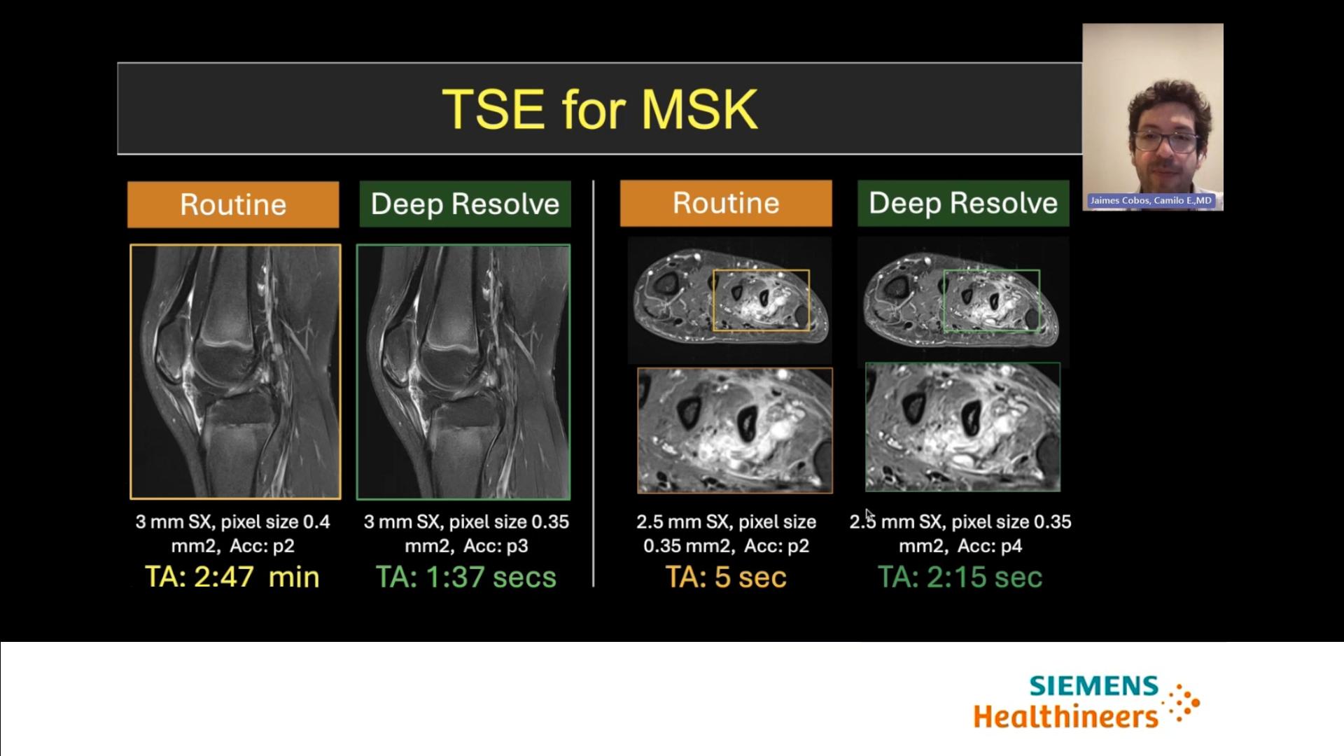 Strategies to Reduce Sedation in Pediatric MRI Exams