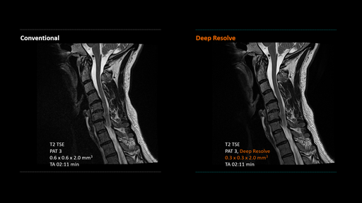 Musculoskeletal Imaging - Siemens Healthineers