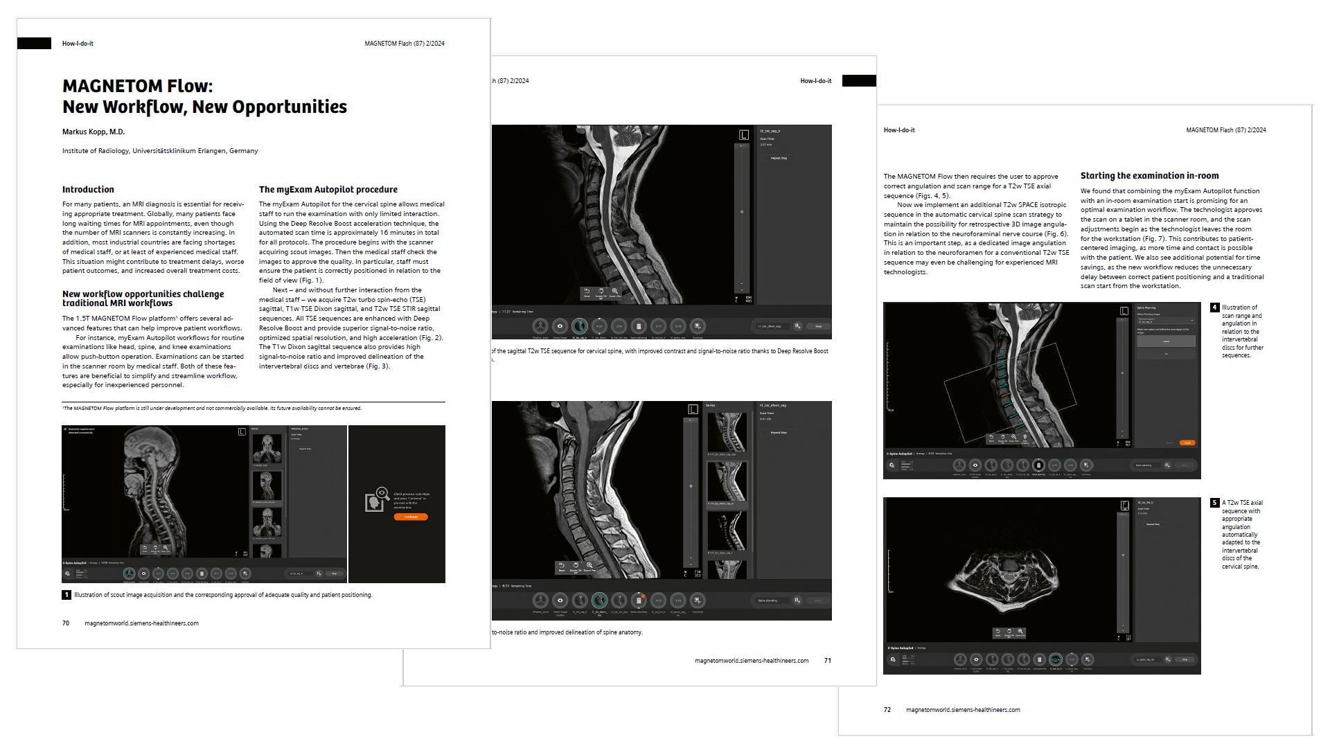 DryCool technology - Siemens Healthineers