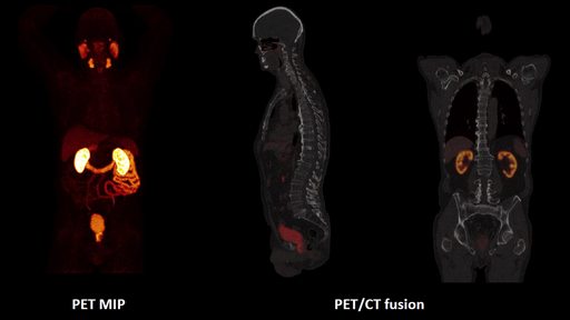 Biograph Vision PET/CT Scanner - Siemens Healthineers