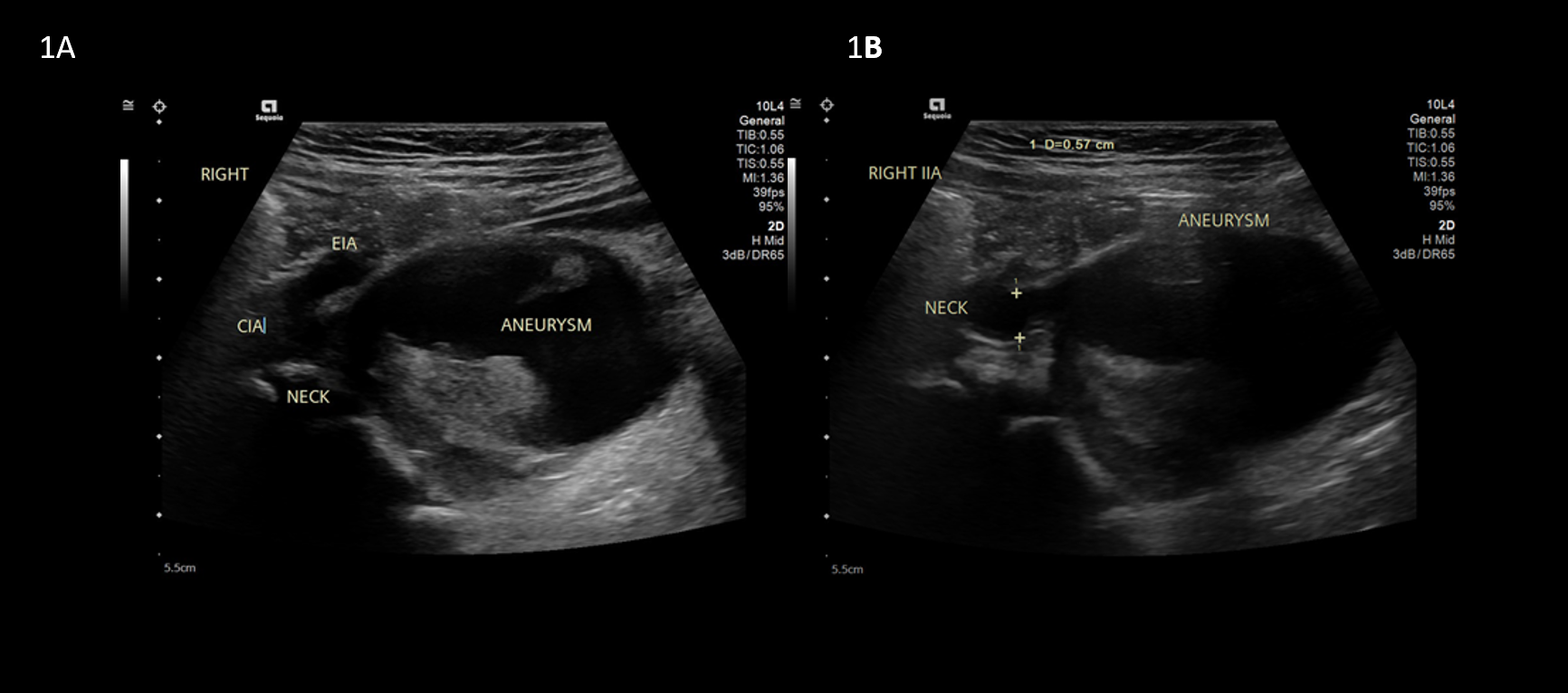 New Technologies help in Rare Ultrasound Case Studies