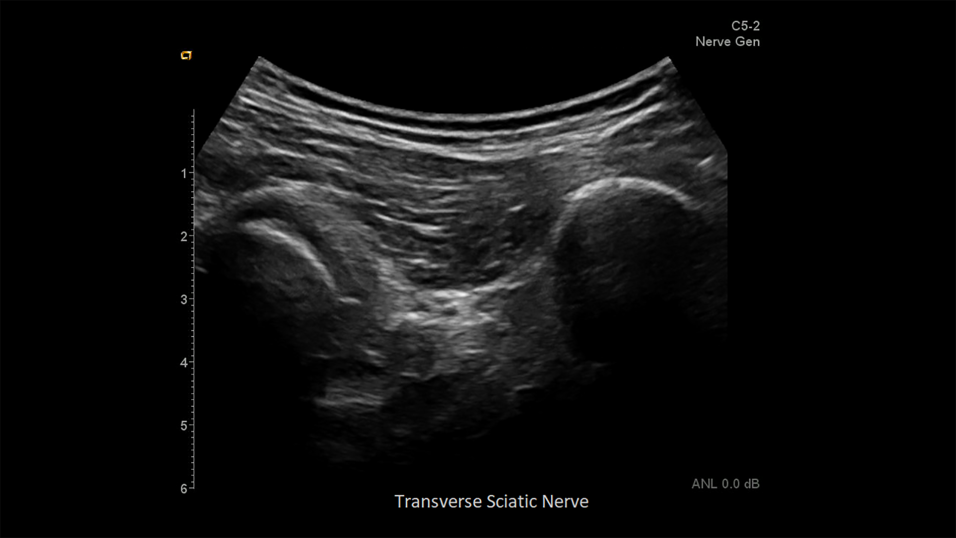 Wireless Ultrasound System | ACUSON Freestyle - Siemens Healthineers