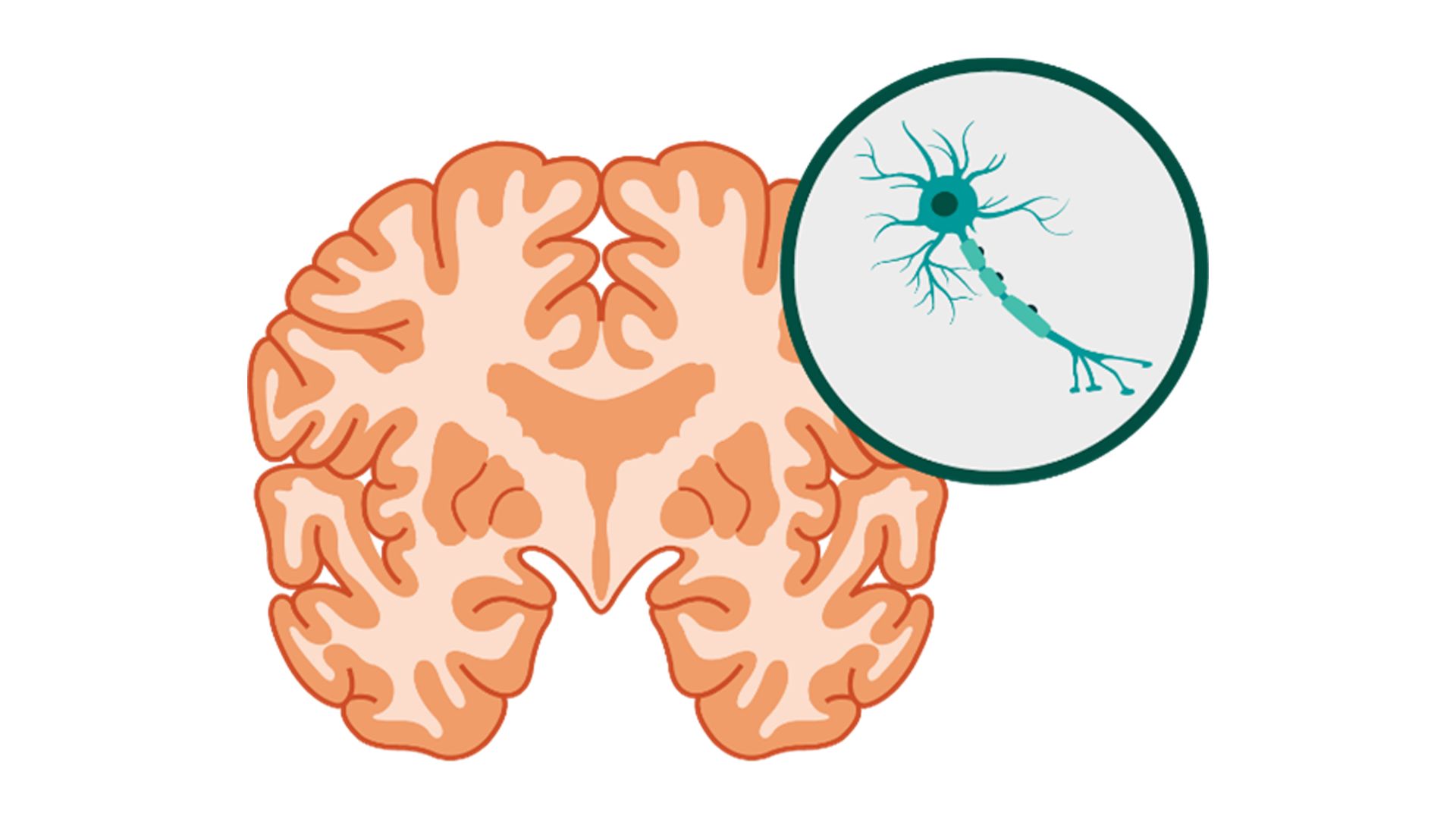 Beta-amyloid PET/CT imaging for Alzheimer's disease - Siemens ...