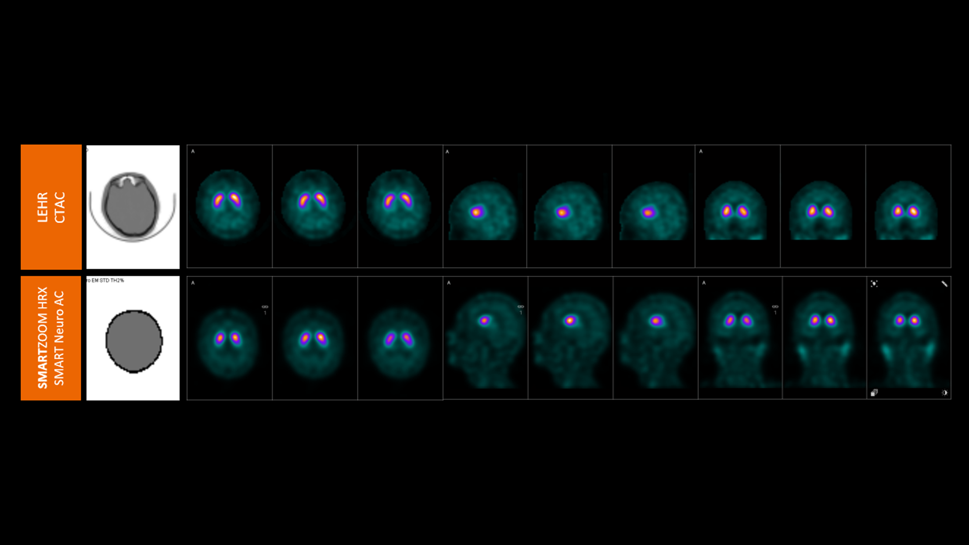 Symbia Pro.specta SPECT/CT - Siemens Healthineers Česká republika