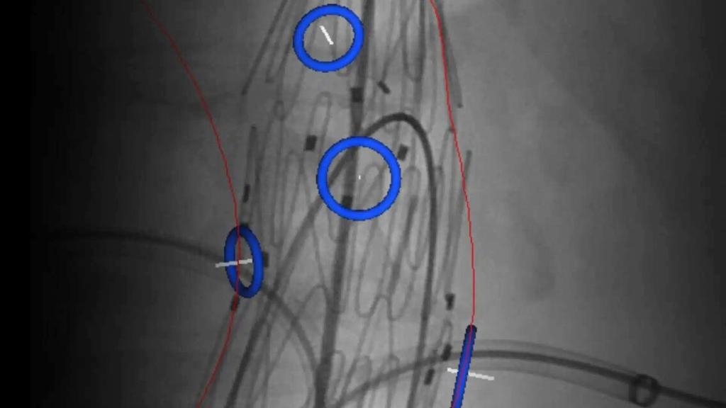syngo DynaCT - Siemens Healthineers