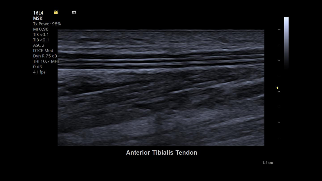 ACUSON Maple is a High-Performance Shared Service Ultrasound System ...