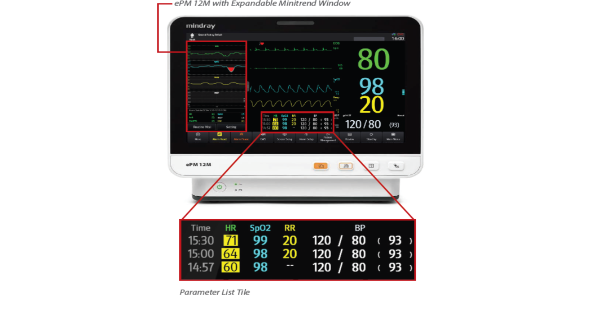 Mindray Patient Monitors - Siemens Healthineers USA