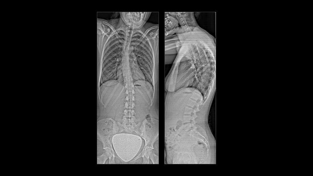 Twin Robotic X-ray scanner – Multitom Rax - Siemens Healthineers