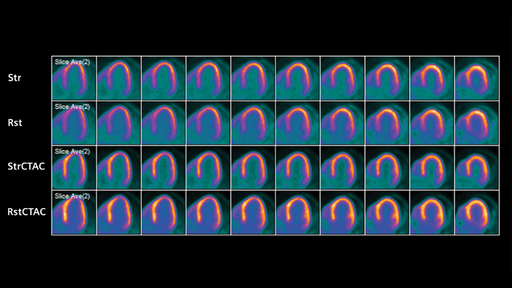 Biograph Vision PET/CT Clinical Image Gallery - Siemens Healthineers
