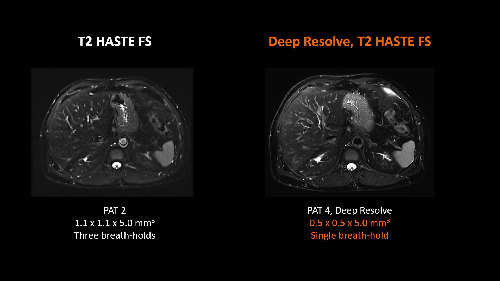MAGNETOM Skyra Fit - Siemens Healthineers