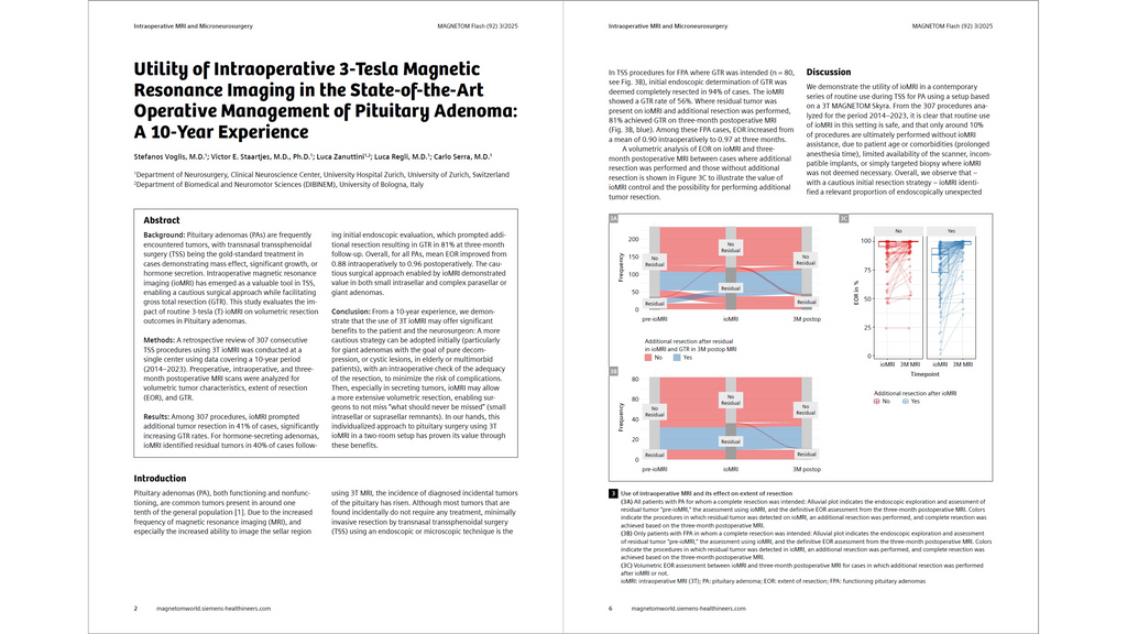 Intraoperative MRI-Guided Neurosurgery