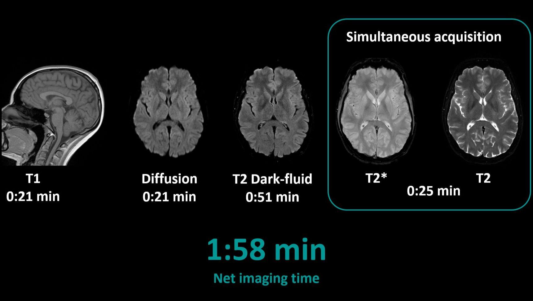 Neurology MRI - Siemens Healthineers