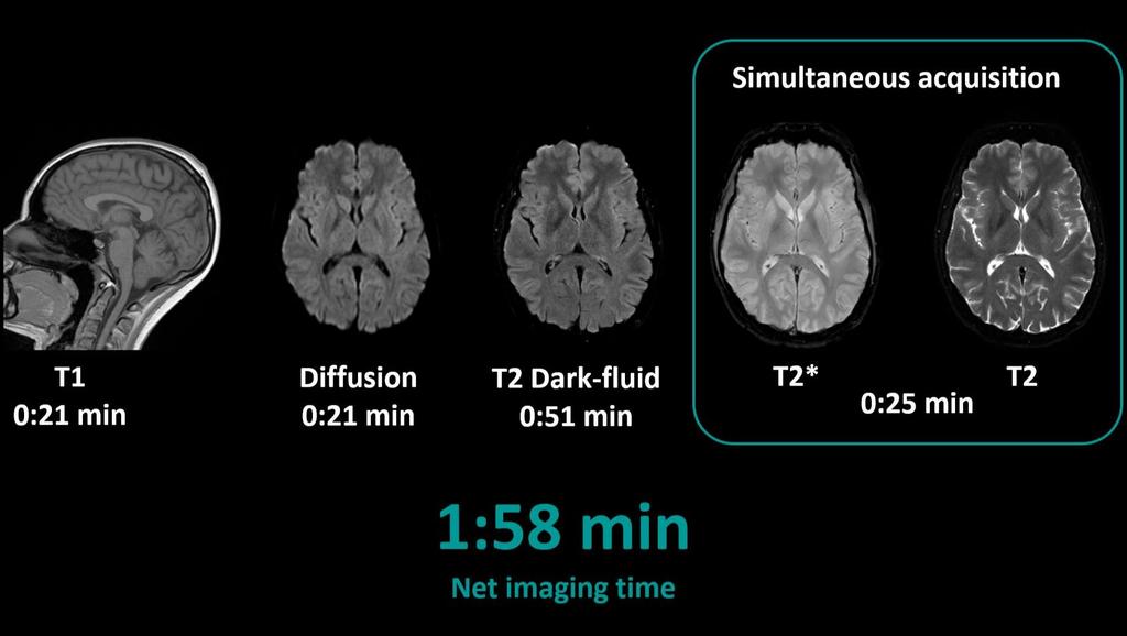 Neurology MRI - Siemens Healthineers