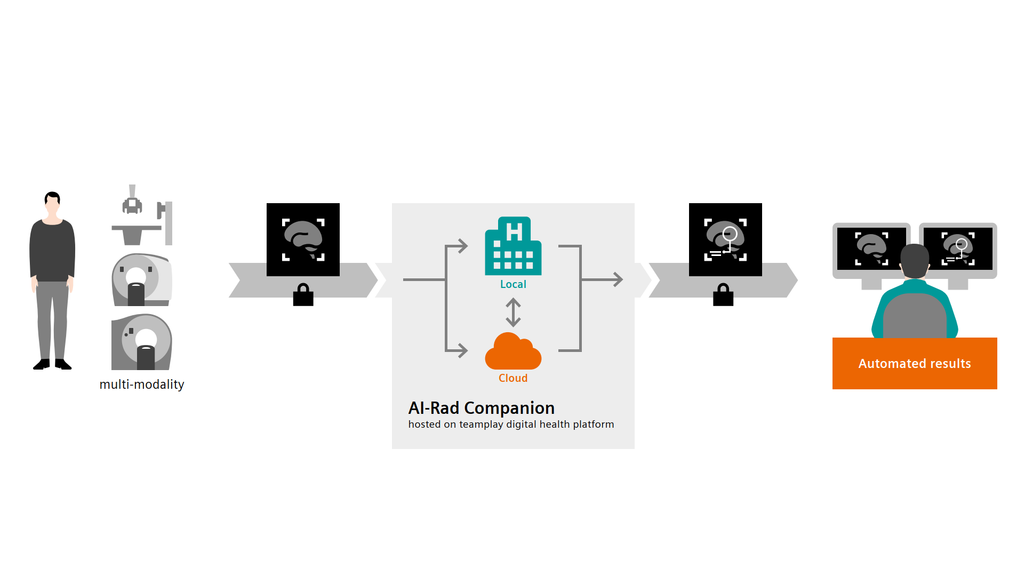AI-Rad Companion - Siemens Healthineers